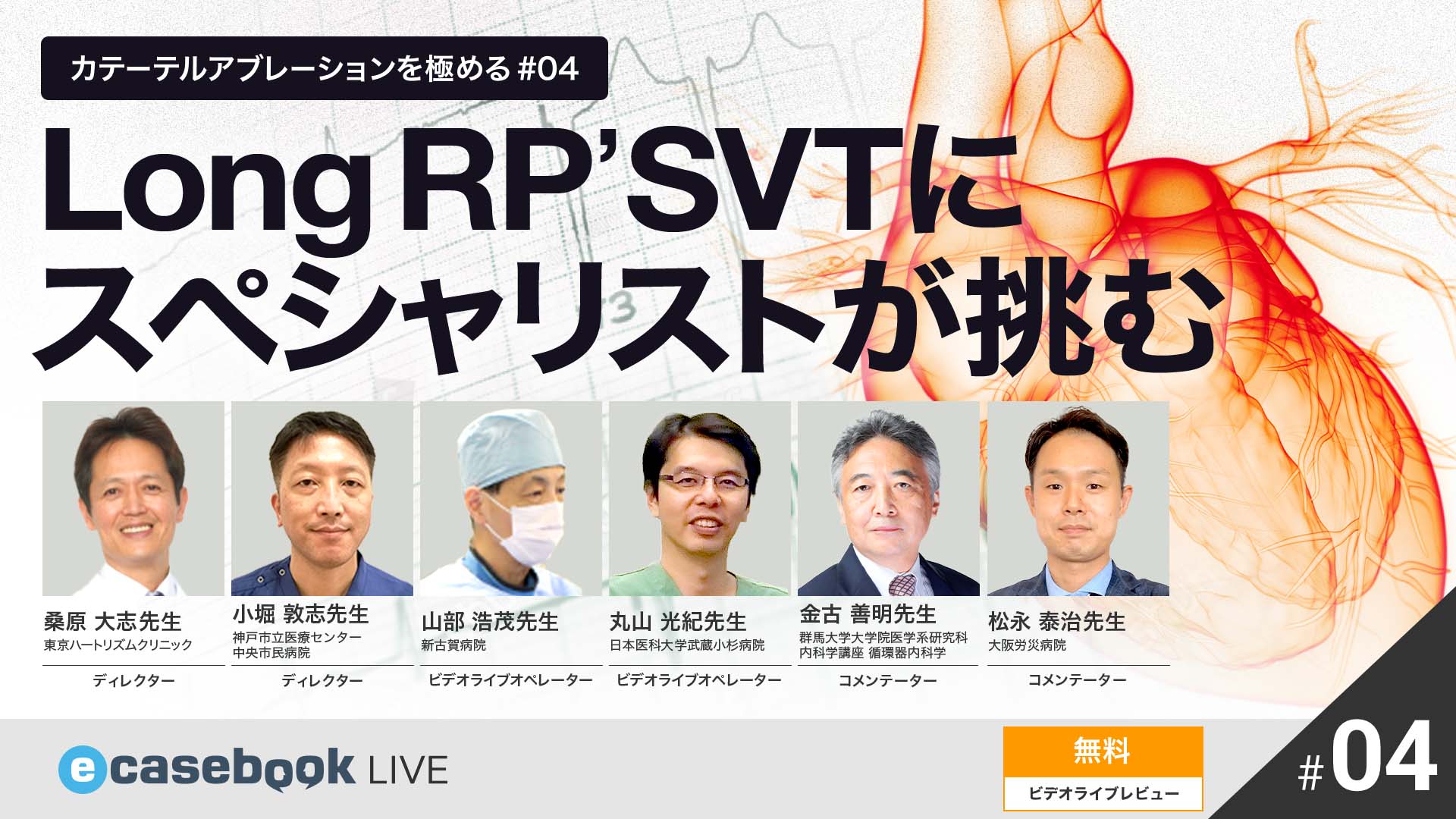 VIDEO: Long RP’ SVTにスペシャリストが挑む | Cardiology | e-casebook LIVE