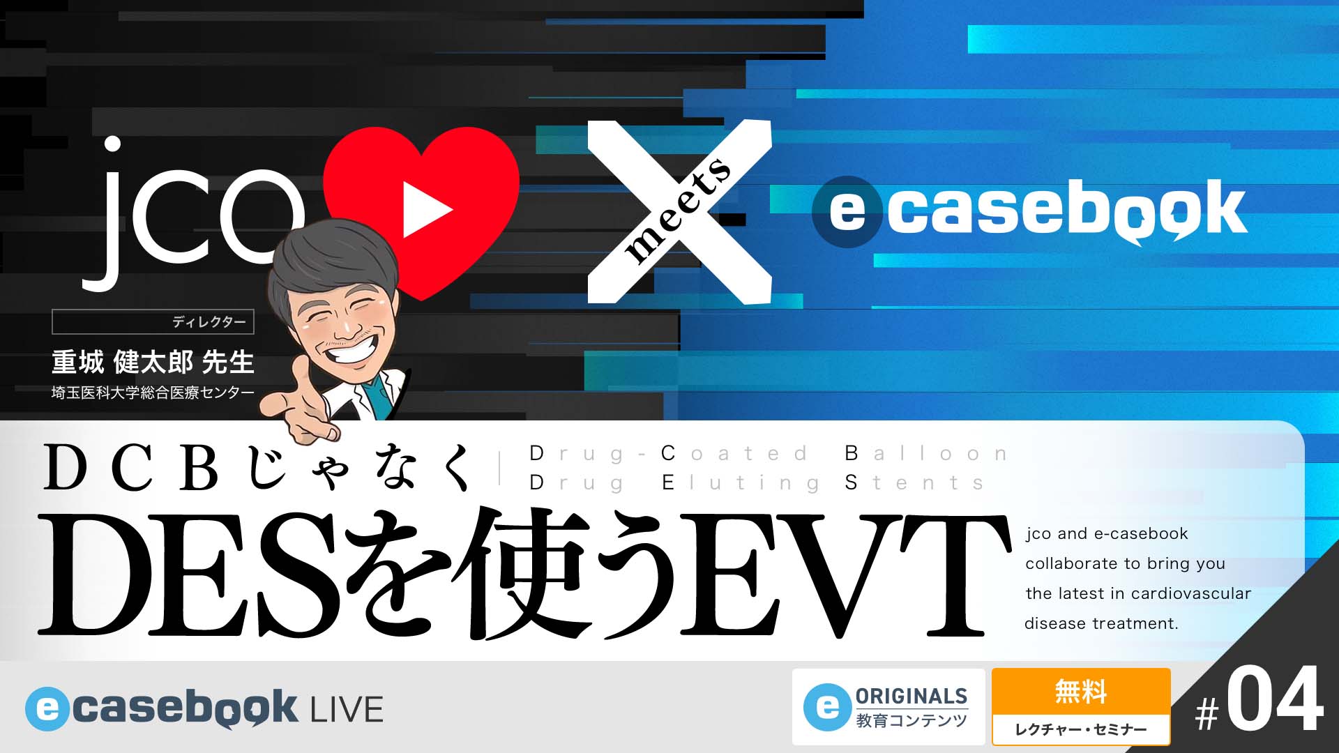 VIDEO: DCBじゃなくDESを使うEVT | Cardiology | e-casebook LIVE