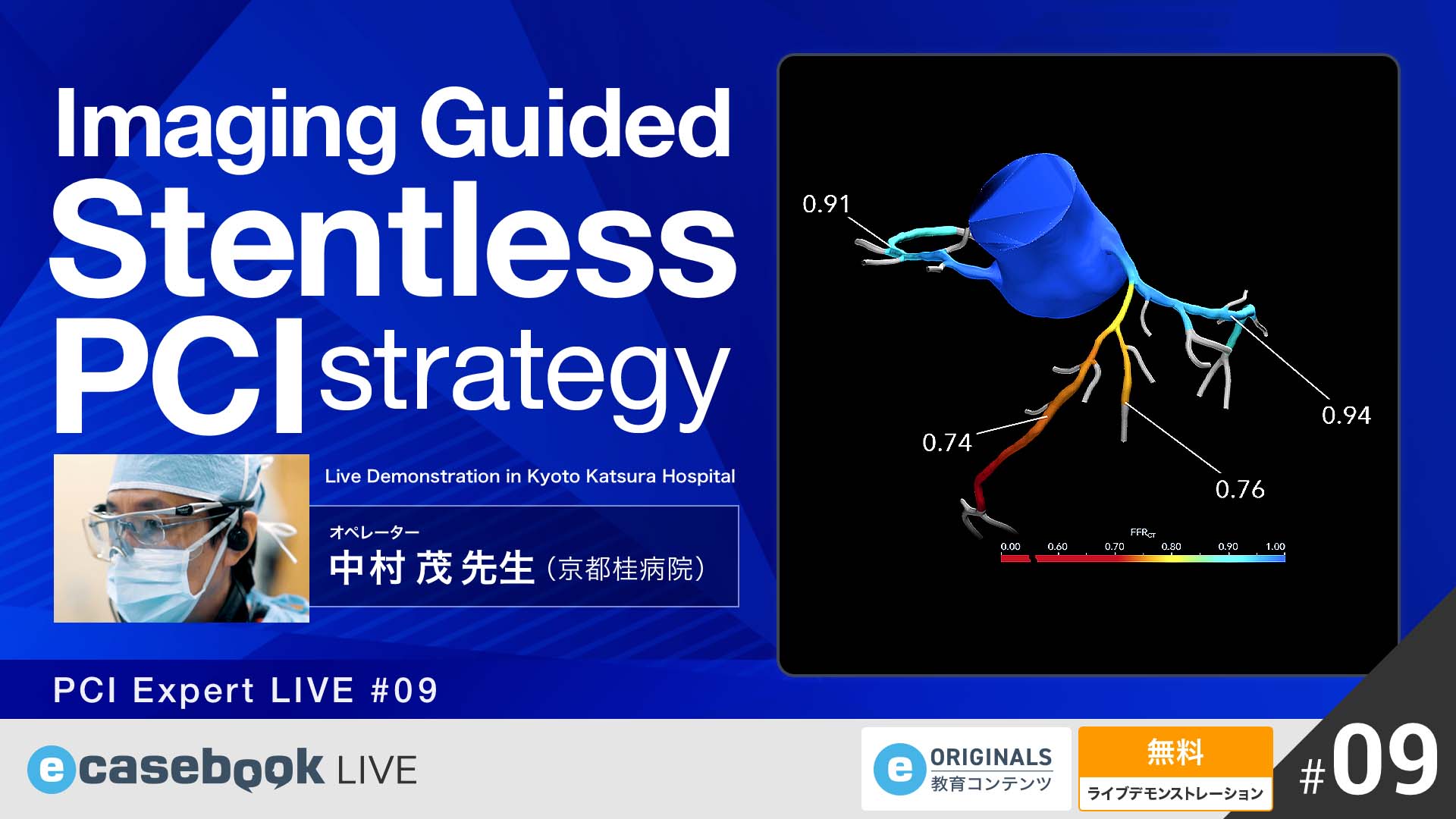 VIDEO: Imaging Guided Stentless PCI strategy | Cardiology | e-casebook LIVE