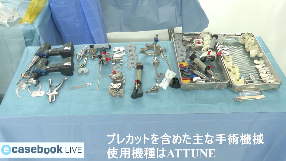 VIDEO: 後十字靭帯温存/切除型共用TKA プレカット法 [TKA] | Orthopedics | e-casebook LIVE