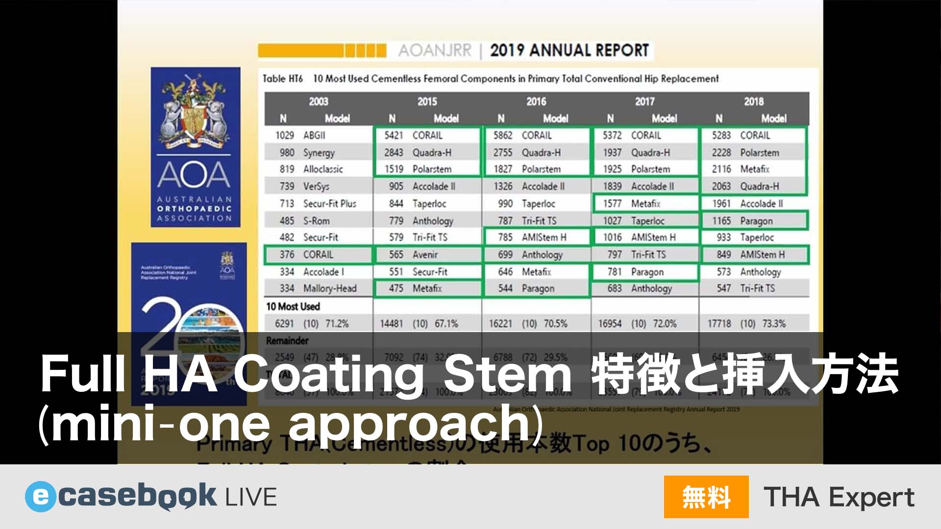 VIDEO: Full HA Coating Stem 特徴と挿入方法 (mini-one approach) [THA ...