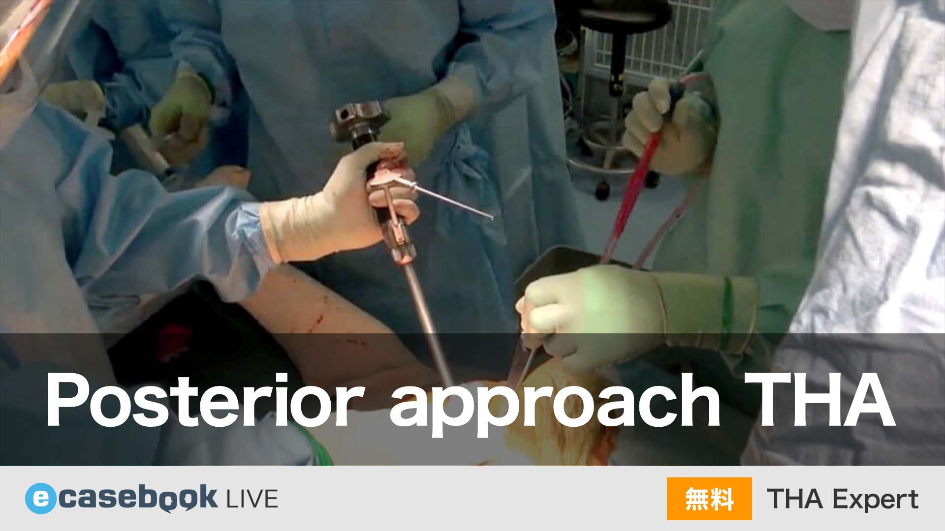 VIDEO: Posterior approach THA [THA] | Orthopedics | e-casebook LIVE